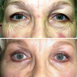 Festoons: the baggage you don't need!