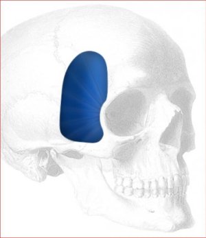 Facial Implants for Men Richmond VA | Facial Cosmetic Surgery for Men