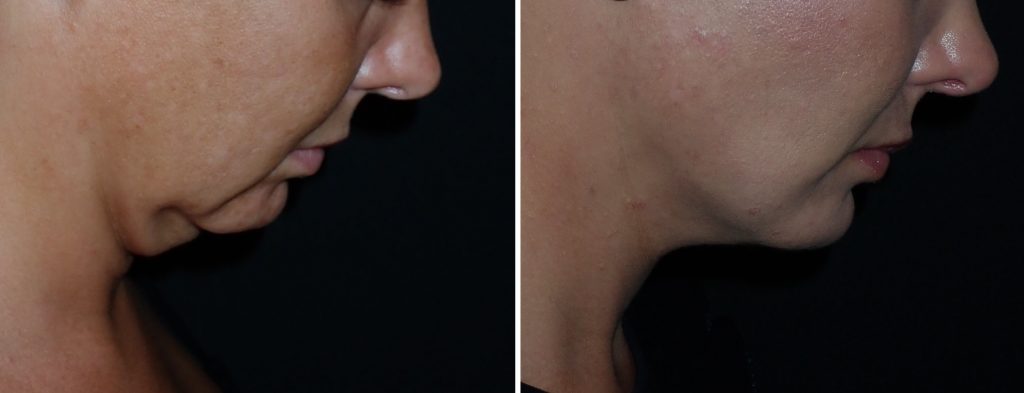 Today's Great Little Case