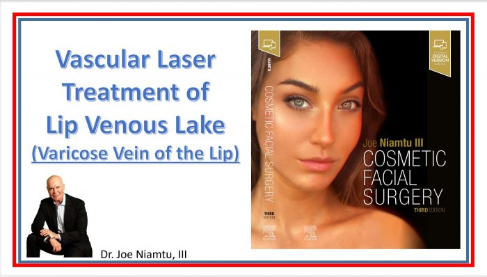 Vascular Laser Treatment of Venous Lake (Varicose Vein) on the Lip.