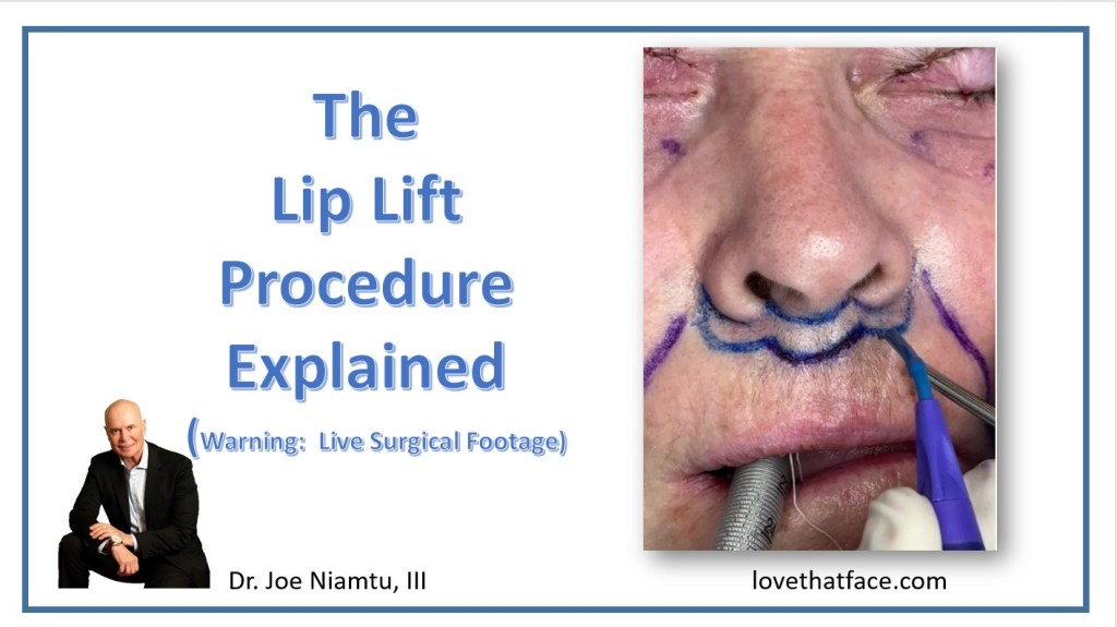 Lip Lift Procedure Explained