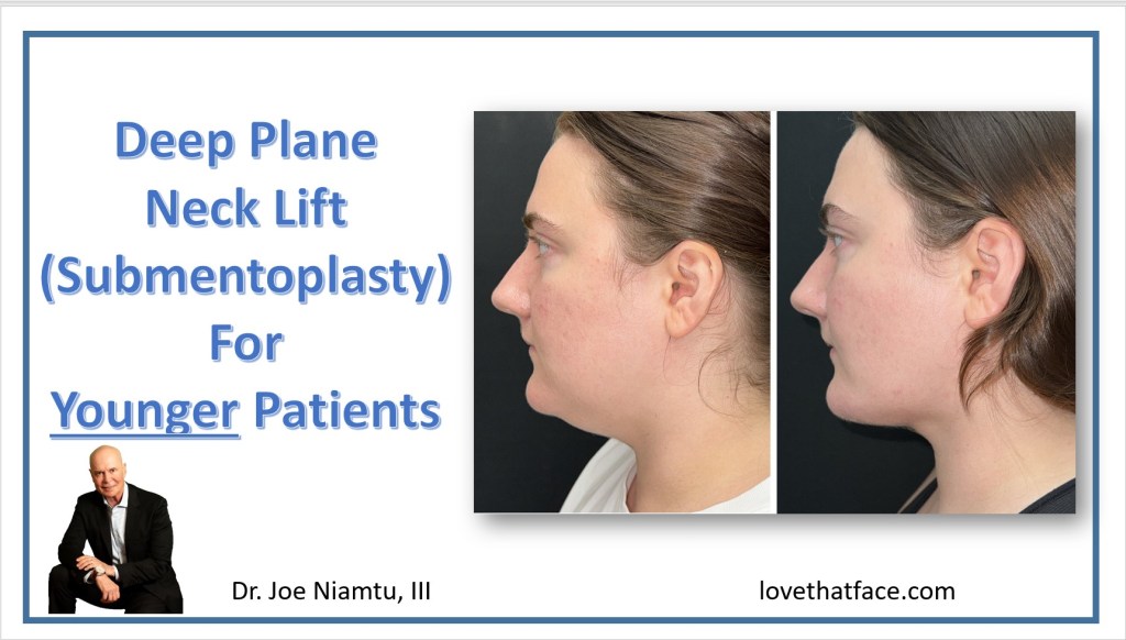 Submentoplasty Richmond VA