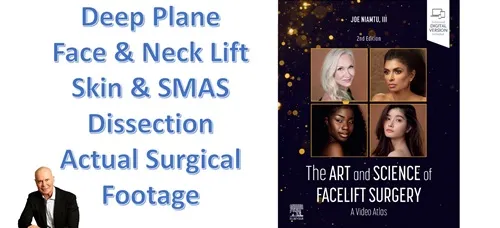 Facelift Richmond | Neck Lift Richmond | More Than 1300 Facelifts
